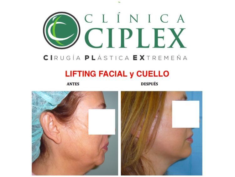 Clínica CIPLEX - Multiestetica.com