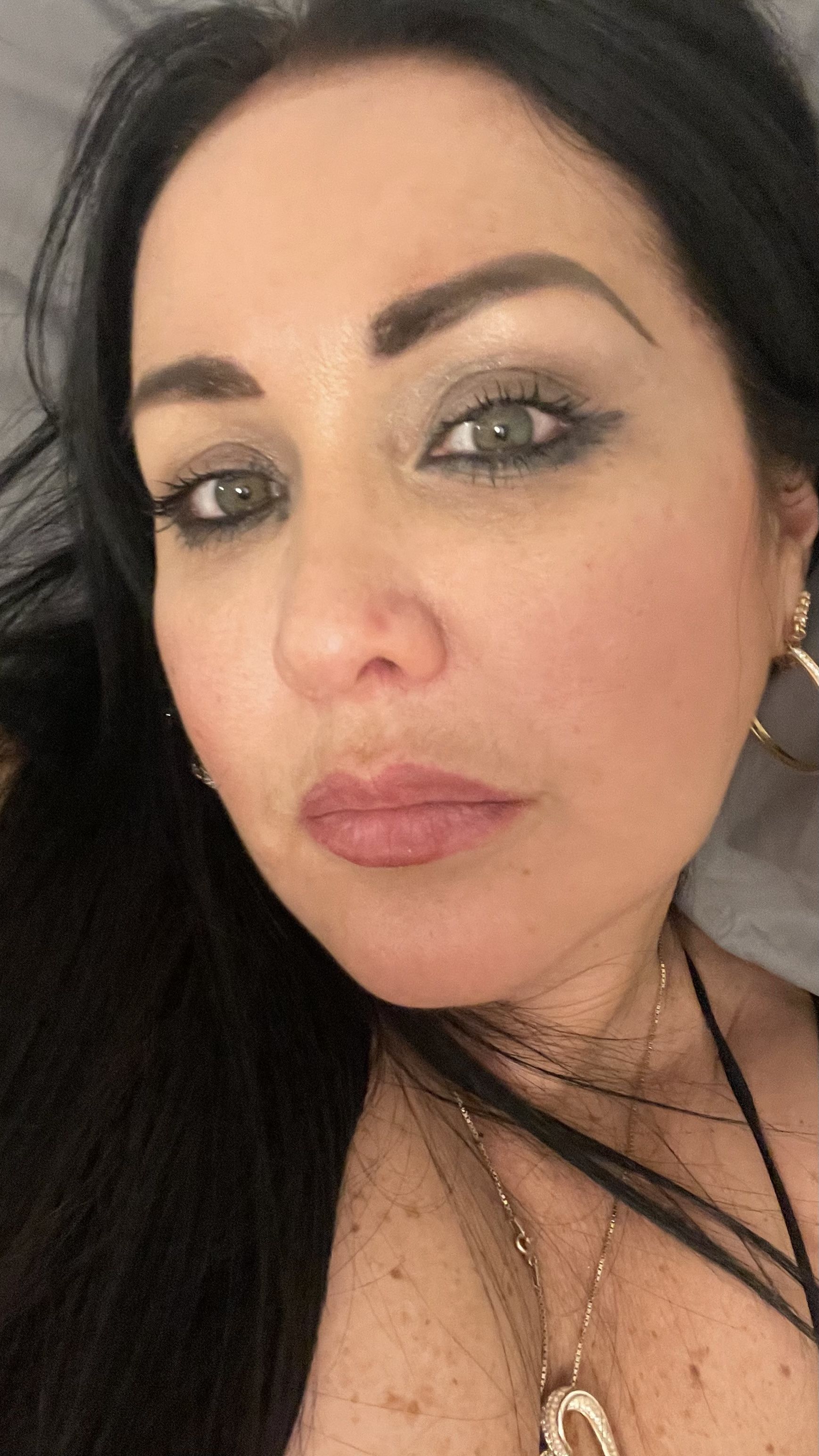 Hilos tensores efecto lifting - Hilos tensores - Multiestetica.com