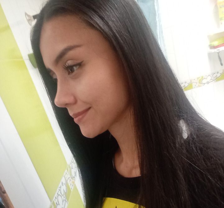 Nariz muy respingada -estoy preocupada - Rinoplastia - Multiestetica.com